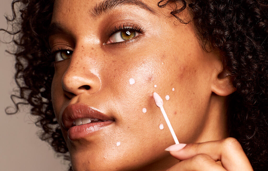 Acne Types, Causes, and Treatments – Kate Somerville US