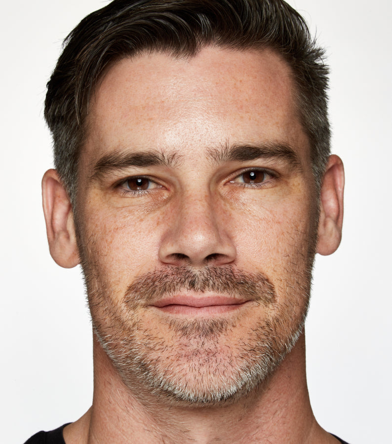 Botox – Kate Somerville US