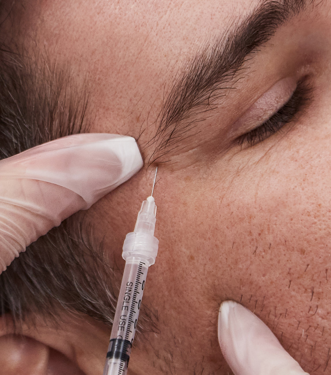 Botox – Kate Somerville US